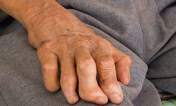 Dermatologistas temem falta medicamentos para hanseníase e acionam ...