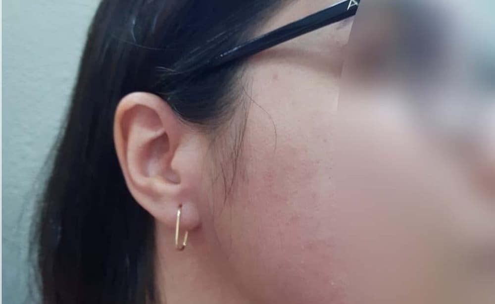 Professora é agredida com soco no rosto por mãe de aluno | Jornal de ...