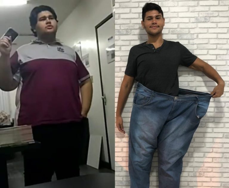 Jovem de 24 anos perde 91 quilos durante a pandemia | Jornal de Brasília