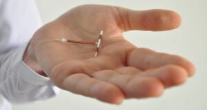 Mini DIU: Conheça o DIU para úteros pequenos! | Jornal de Brasília