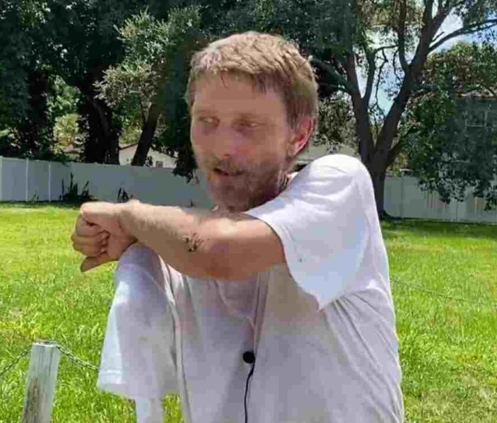 Nos EUA, homem de sobrenome Merda é atacado por jacaré e perde braço ...