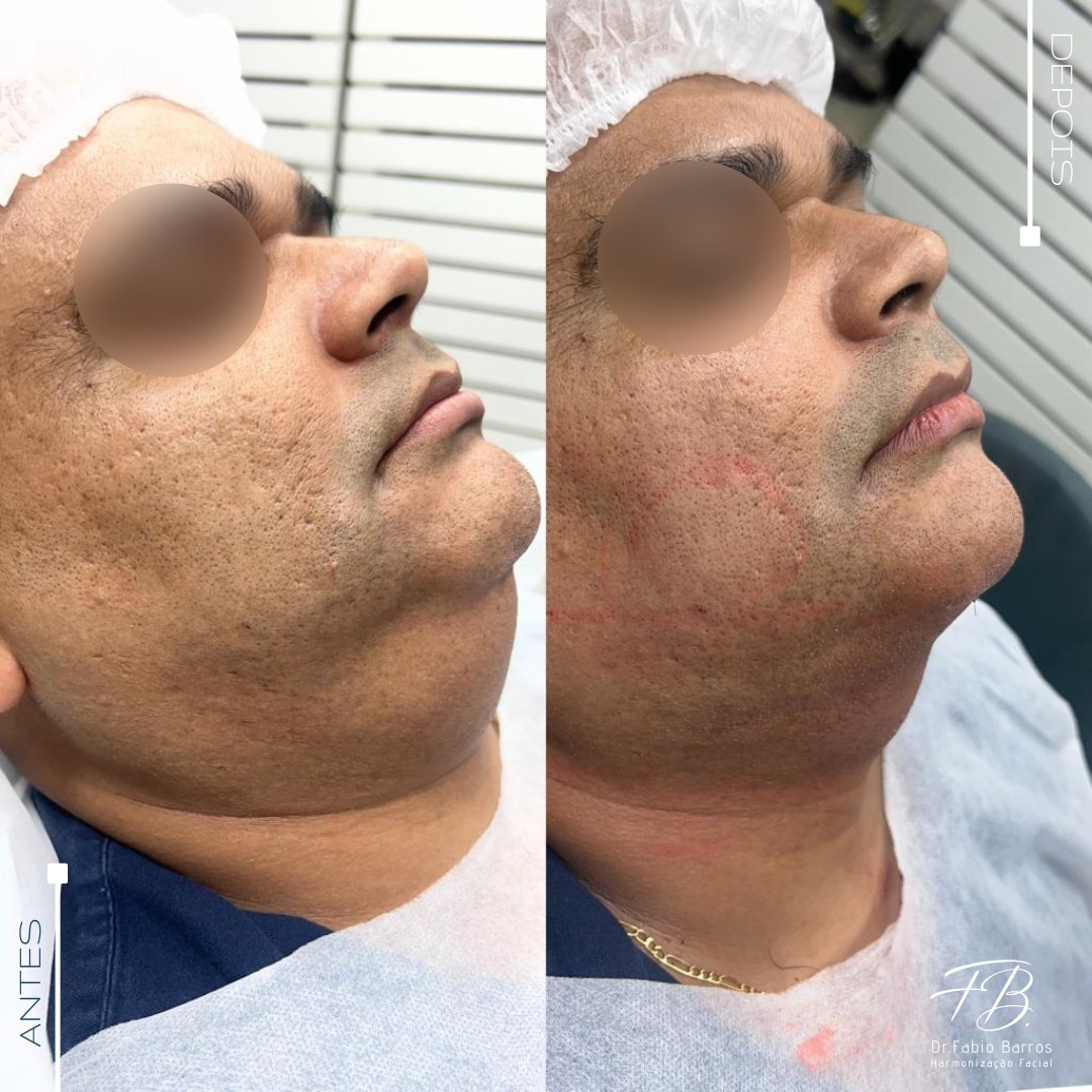 Dr. Fabio Barros, referência em harmonização facial, explica como ...