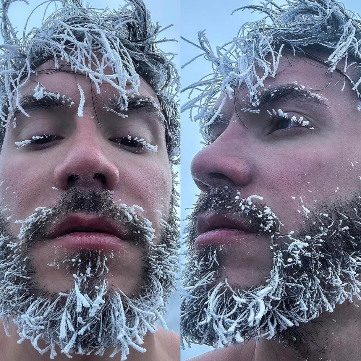 ‘O verdadeiro nevou’, Eliezer mostra seu rosto congelado por frio a -43°C | Jornal de Brasília